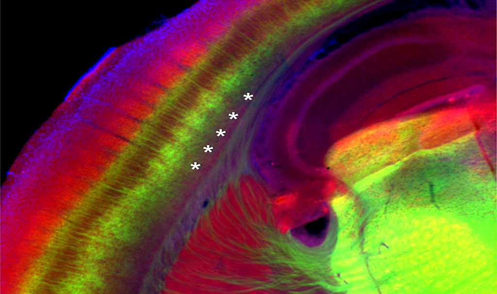 New discovery deepens understanding of brain’s sensory circuitry ... New discovery deepens understanding of brain’s sensory circuitry ...